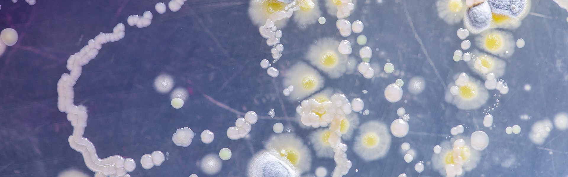 Microbiology Testing Solutions | Neogen